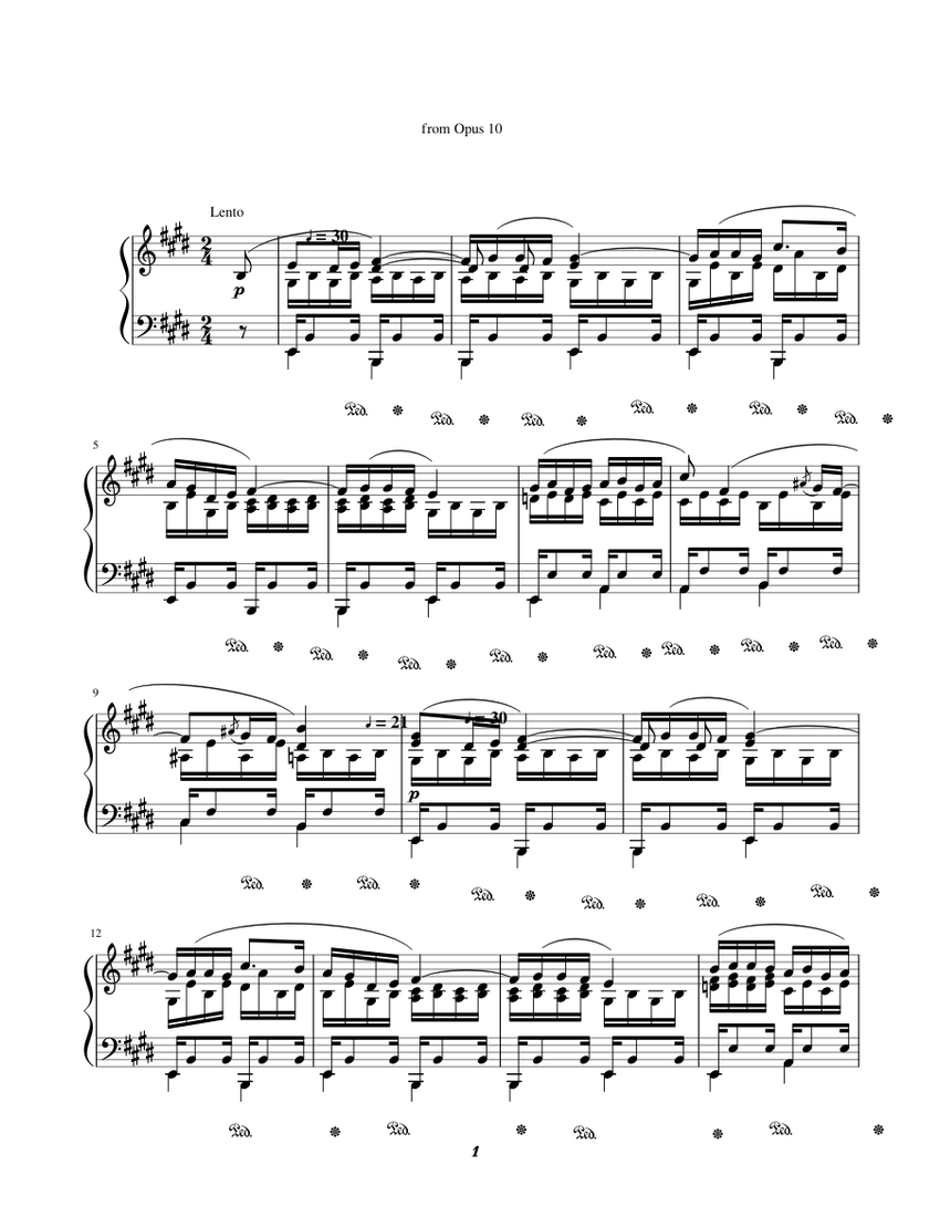 Etude in E major - Frederic Chopin - piano tutorial