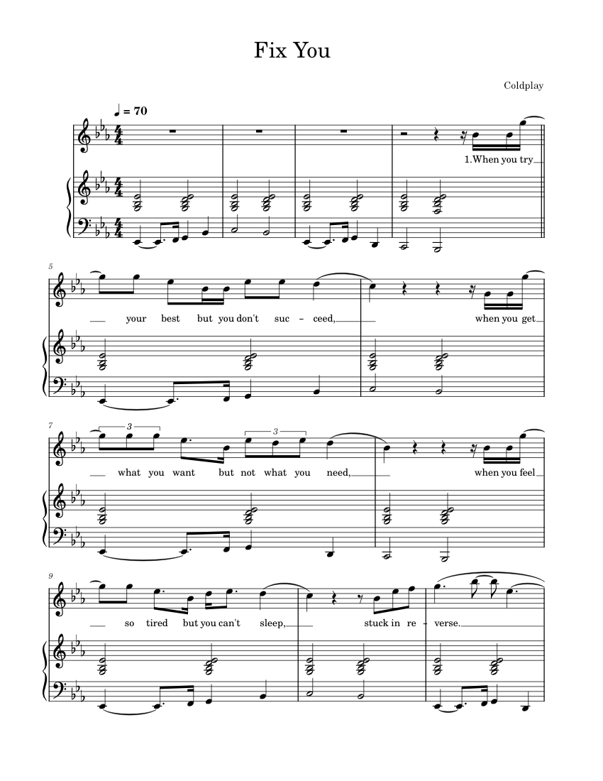 Fix You – Coldplay Fix You Sheet music for Piano (Piano-Voice ...